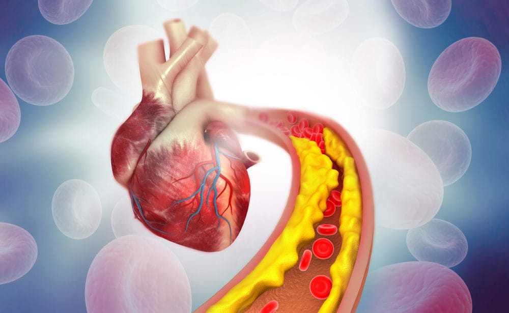 Heart Attack Symptoms & Medical Malpractice | Lansing Injury Law ...
